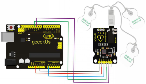 GK-HEART-AD8232 geeekus AD8232 Heart Rate Measurement Sensor Module